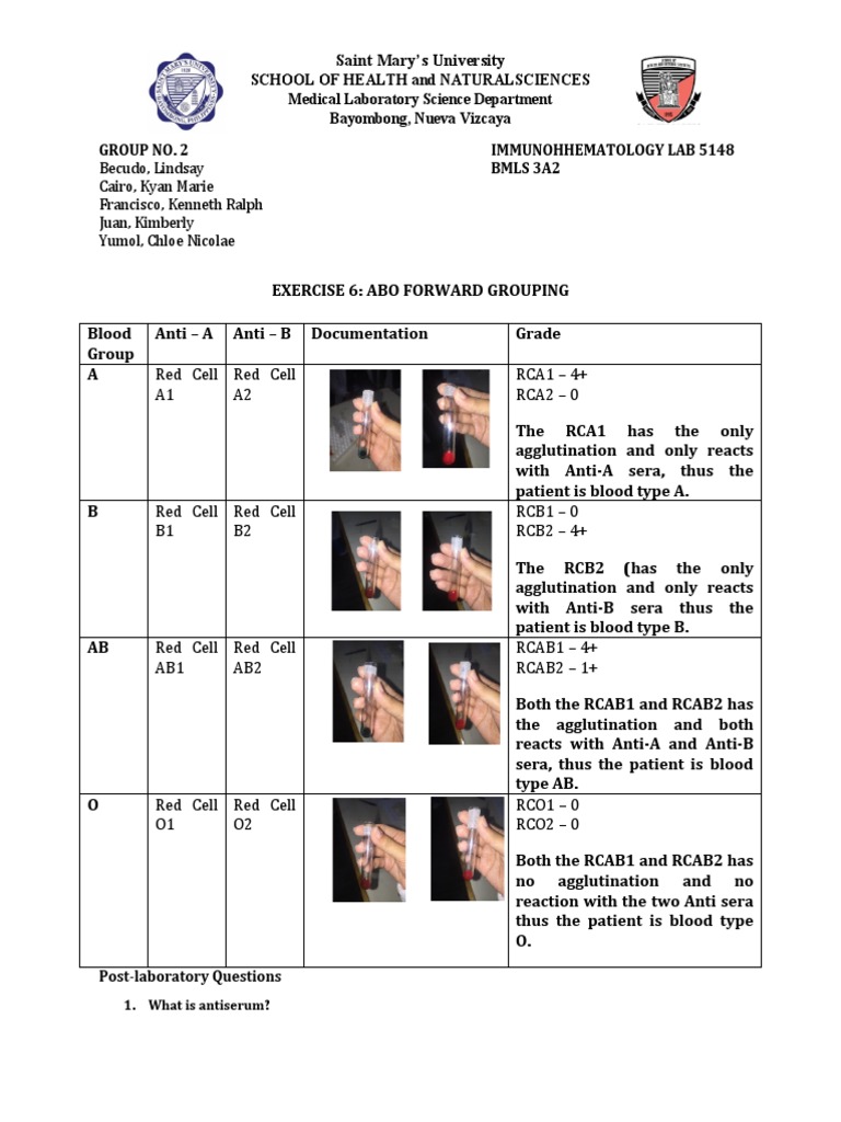 Abo Forward Typing | Download Free PDF | Blood Type | Antibody