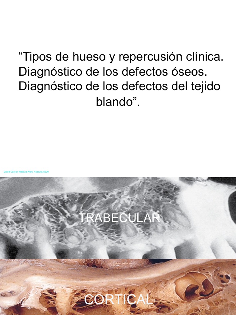 Clasificación de Densidades Óseas y Defectos | PDF | Hueso | Microscopía