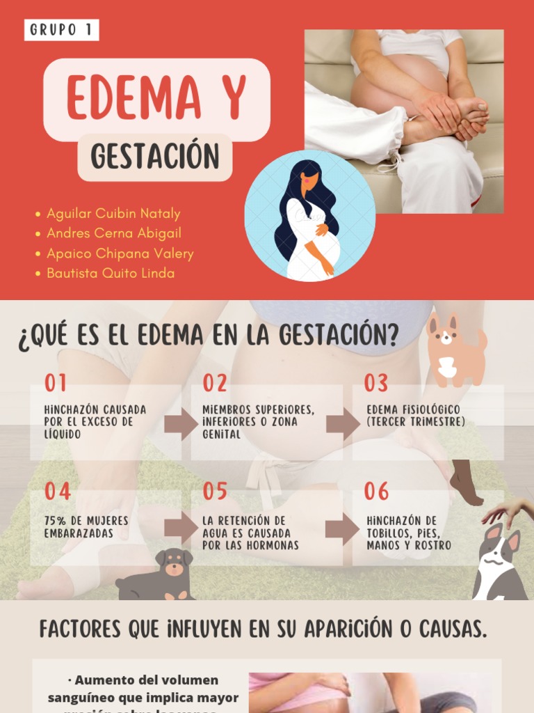 Edema en el Embarazo: Causas y Tratamiento | PDF | Edema | El embarazo