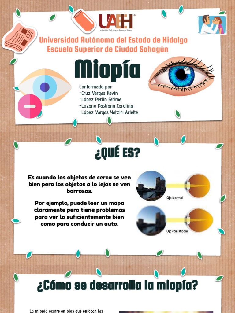 Miopía | PDF | Ojo humano | Percepción visual