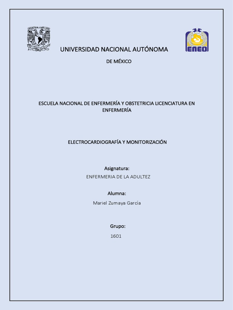 Electrocardiograma MZG | PDF | Electrocardiografia | Sistema cardiovascular