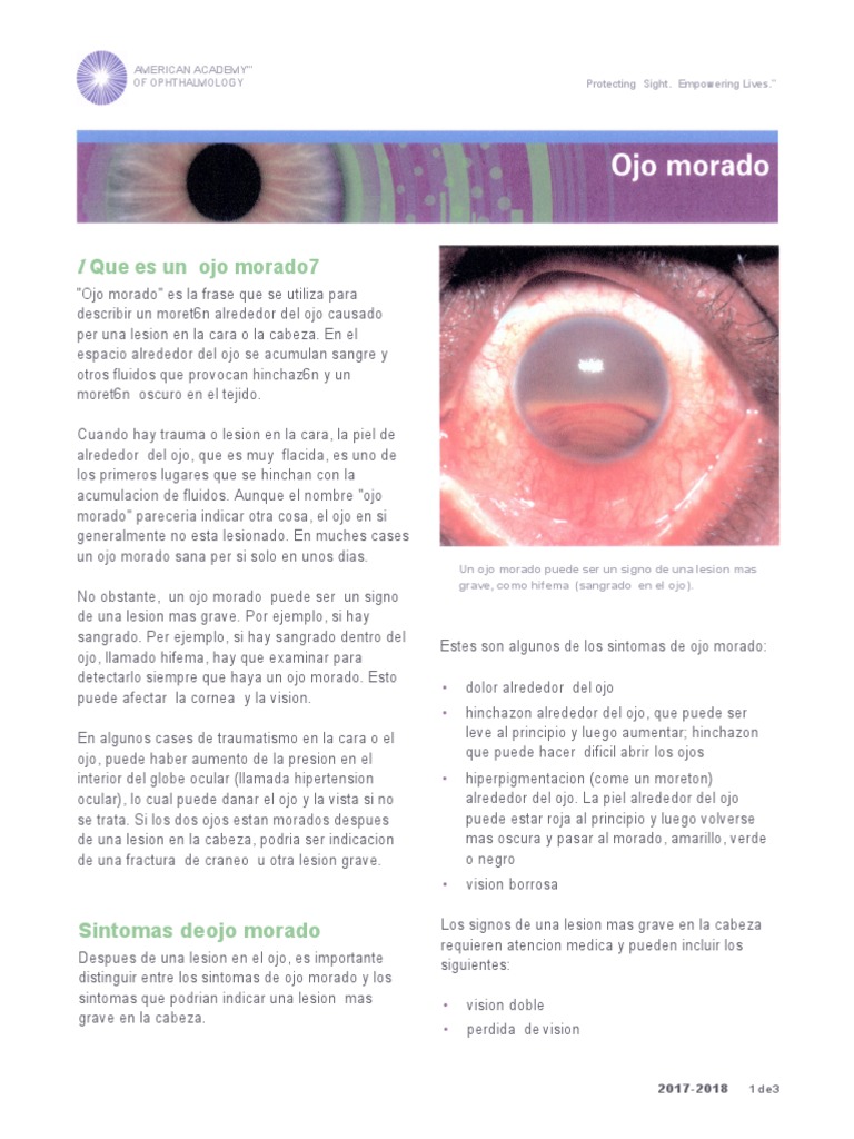Ojo Morado | PDF | Ojo | Lesión