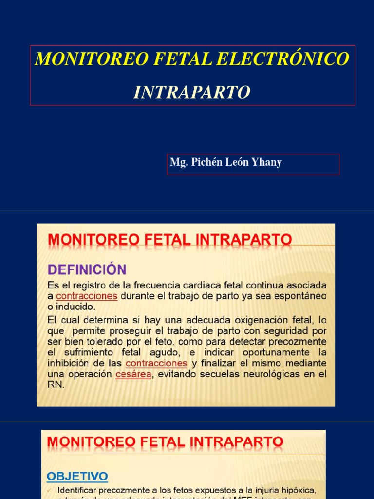 Monitoreo Fetal Intraparto - FC | PDF