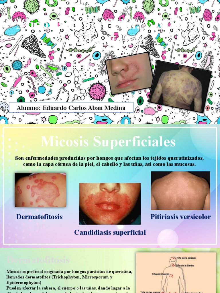 Micosis superficial, y Micosis subcutánea | PDF | Micología | Ciencias ...