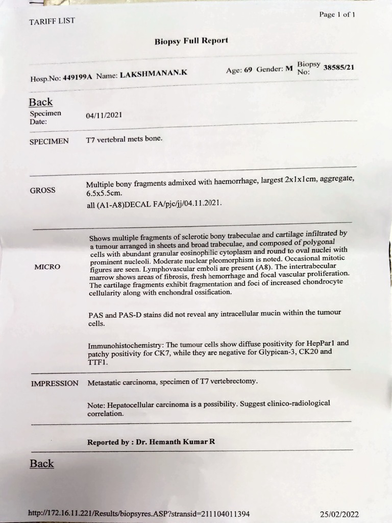Metastatic Carcinoma Biopsy Report | PDF | Bone | Cancer