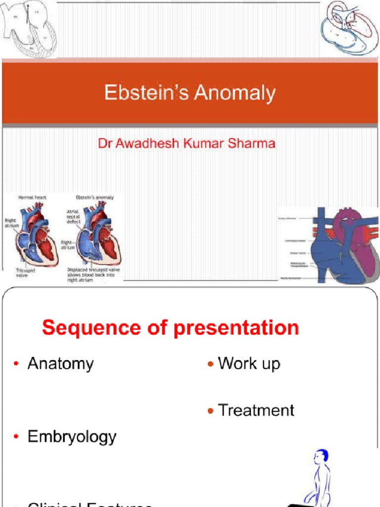 Ebstein Anomaly | PDF