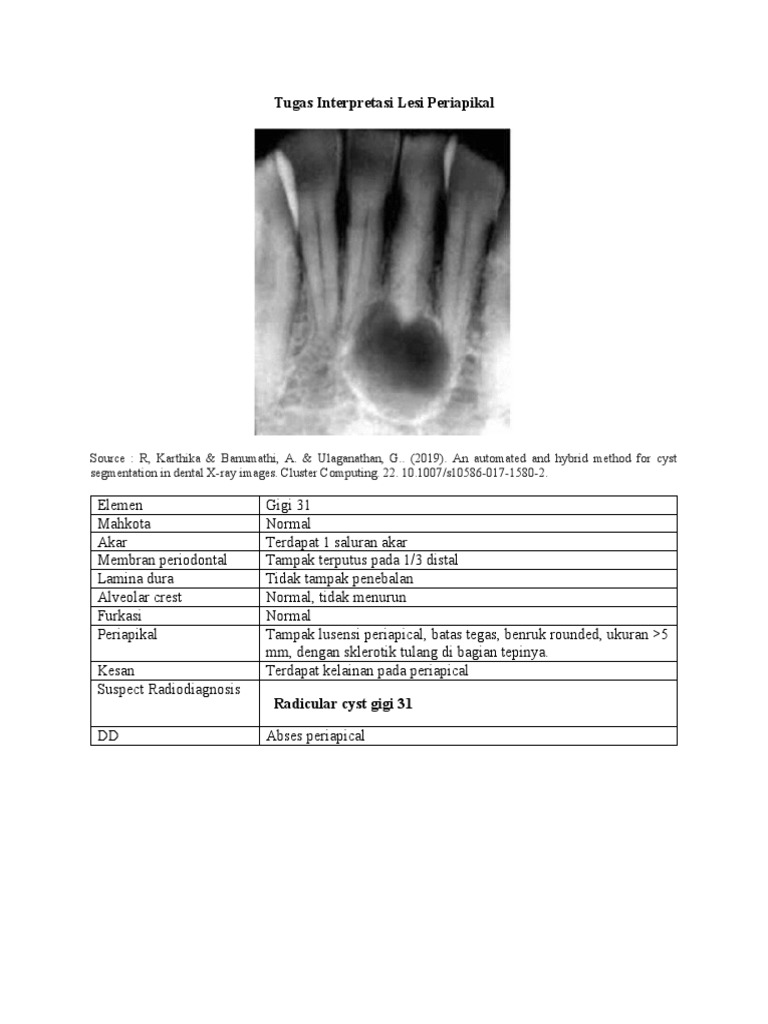 03 Tugas Interpretasi Lesi Periapikal | PDF