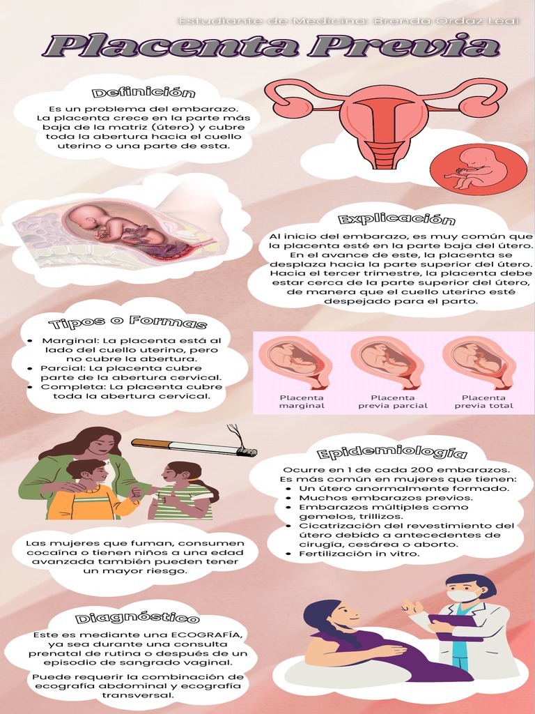 Infografía - Placenta Previa - Ordaz Leal Brenda - 12 | PDF