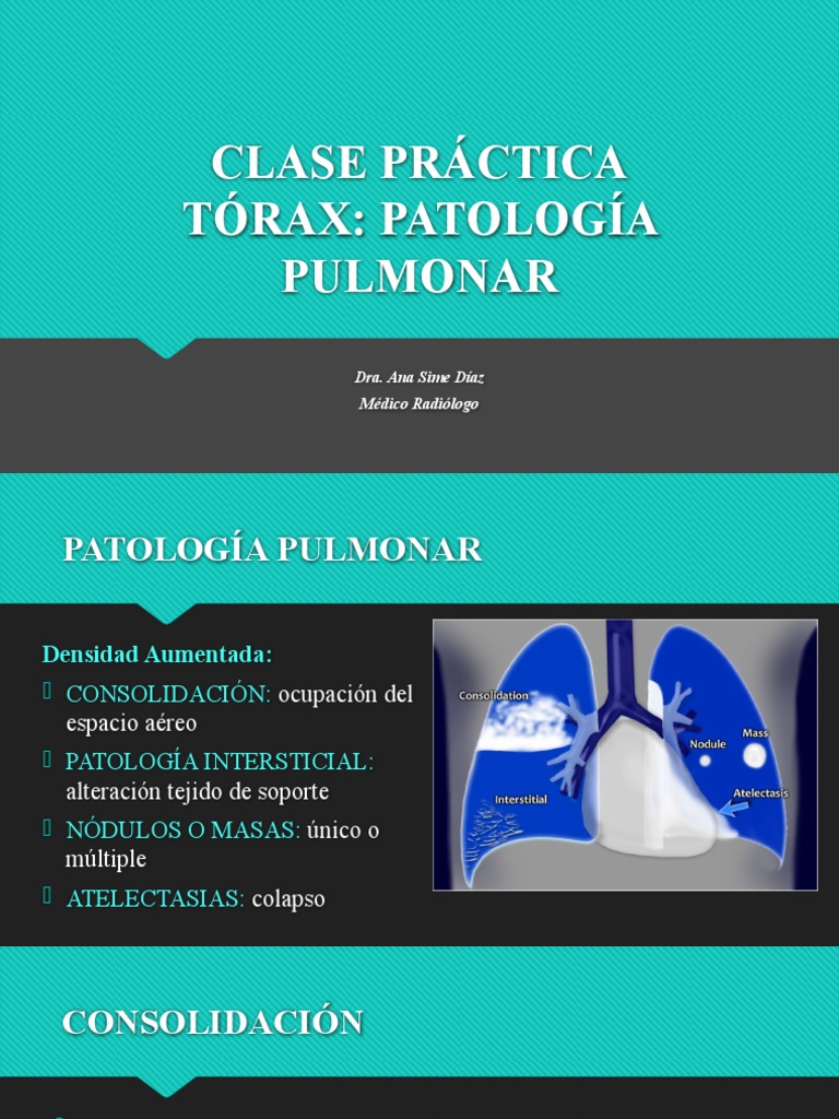 CLASE PRÁCTICA Patologia Torax | PDF | Pulmón | Neumonía