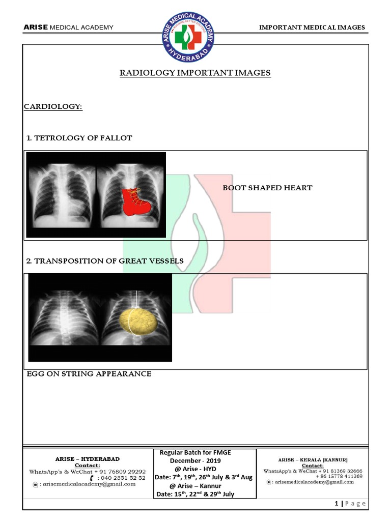 Arise Radio | PDF | Thorax (Human Anatomy) | Causes Of Death