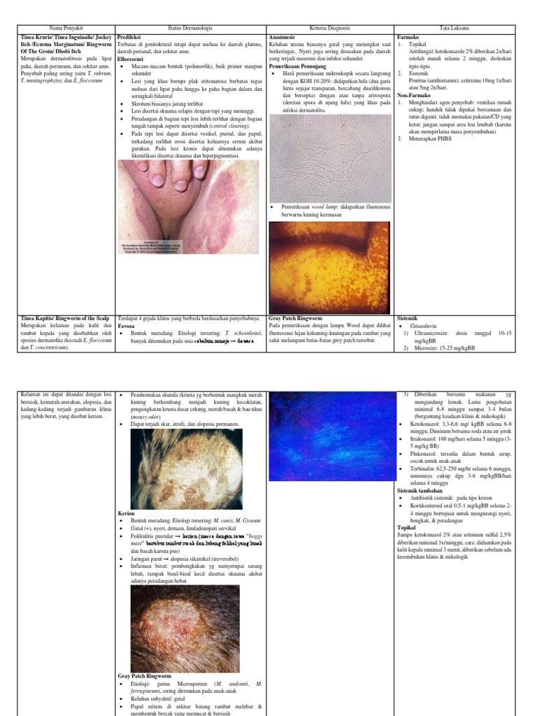 RANGKUMAN Tinea or Pityriasis | PDF
