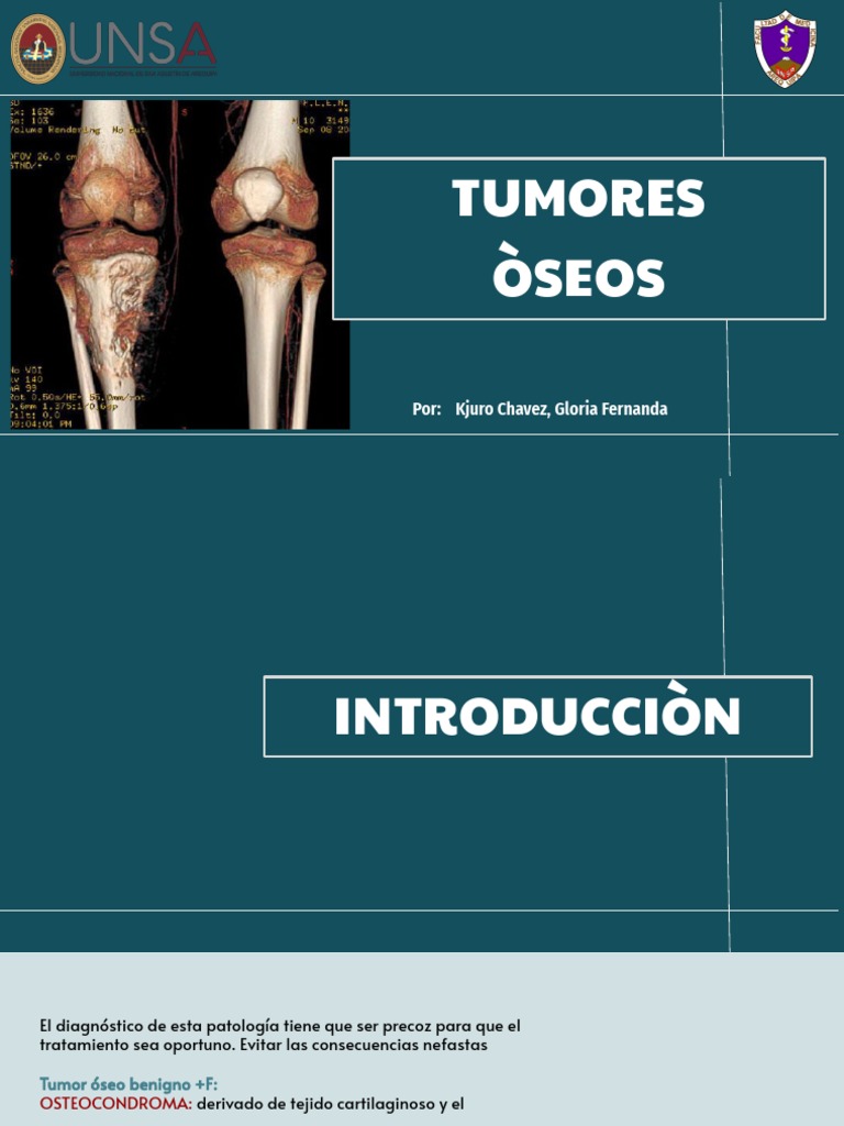 Tumores Òseos | PDF | Hueso | Cáncer