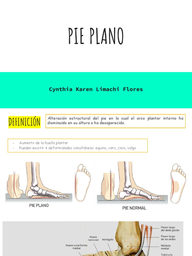 Pie Plano | PDF | Pie | Anatomía del miembro inferior