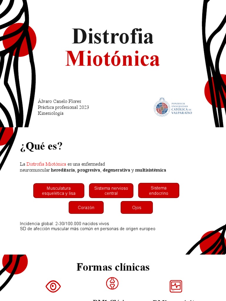 Distrofia Miotónica - Álvaro Canelo | PDF | Causas de la muerte ...