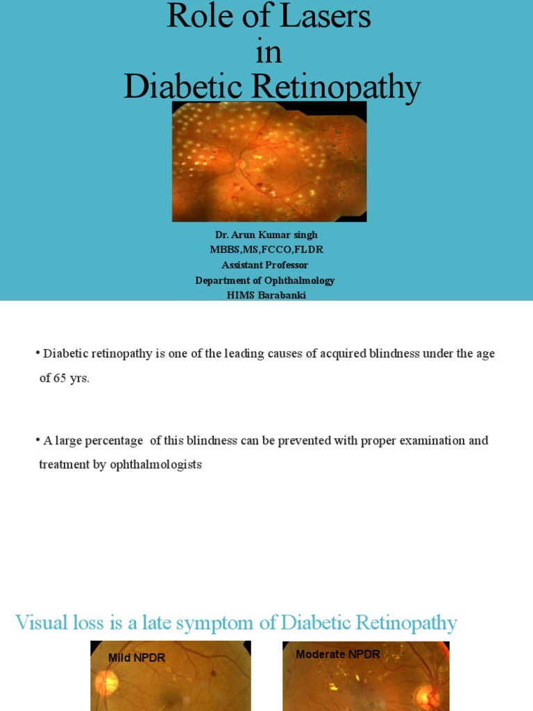 Role of Lasers in Diabetic Retinopathy | PDF | Ophthalmology | Eye