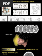 Deterioro Rostrocaudal | PDF