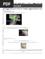 HINTS Exam for Vestibular Assessment | PDF | Vertigo | Vestibular System