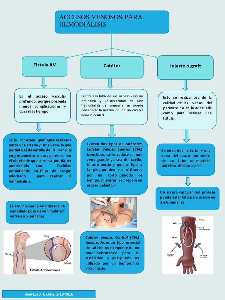 Accesos Venosos para Hemodialisis | PDF | Hemodiálisis | Enfermedades y trastornos