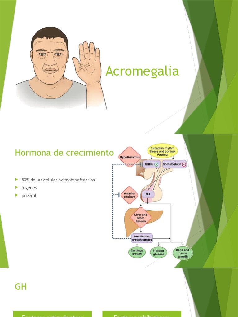 Acromegalia | PDF | Hormona de crecimiento | Medicina CLINICA