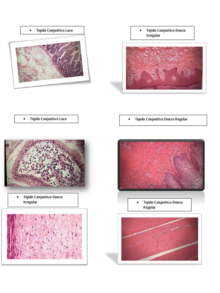 Tipos de Tejido | PDF