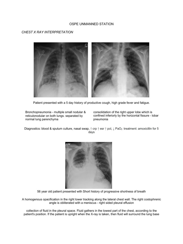 OSPE UNMANNED STATION - Chest X Ray | PDF | Lung | Pneumonia