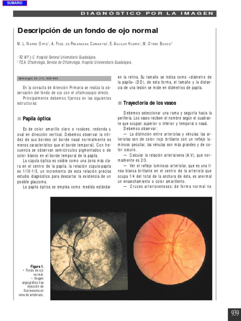 Fondo de Ojo Normal | PDF
