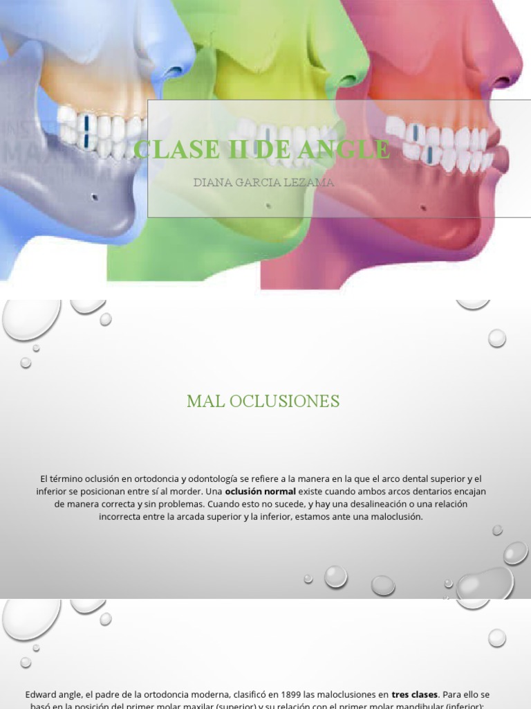 Clase Ii de Angle: Diana Garcia Lezama | PDF | Ortodoncia | Odontología