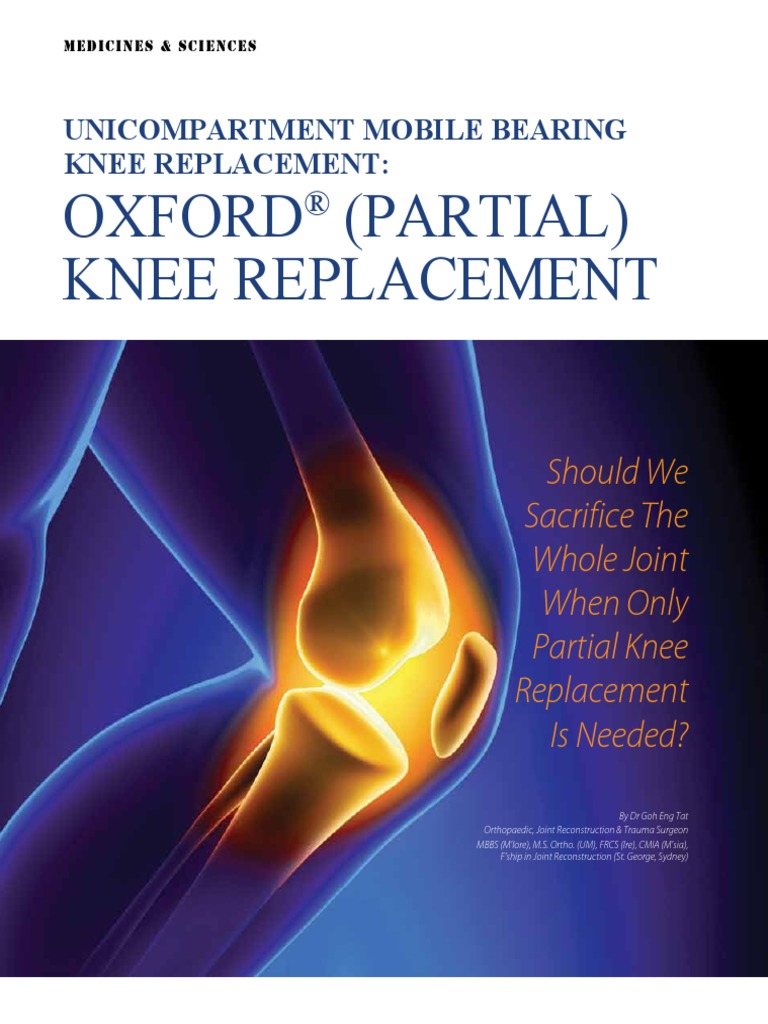 Partial Knee Replacement by DR Goh Eng Tat | PDF | Knee | Joints