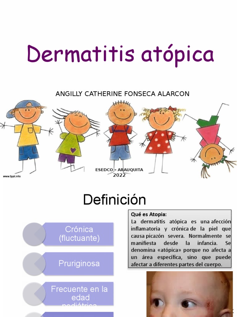Dermatitis Atópica: Causas y Tratamiento | PDF | Alergia | Enfermedades ...