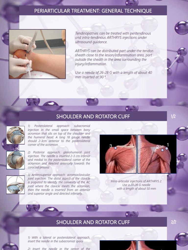 ARTHRYS Training EN - Gân | PDF | Shoulder | Elbow