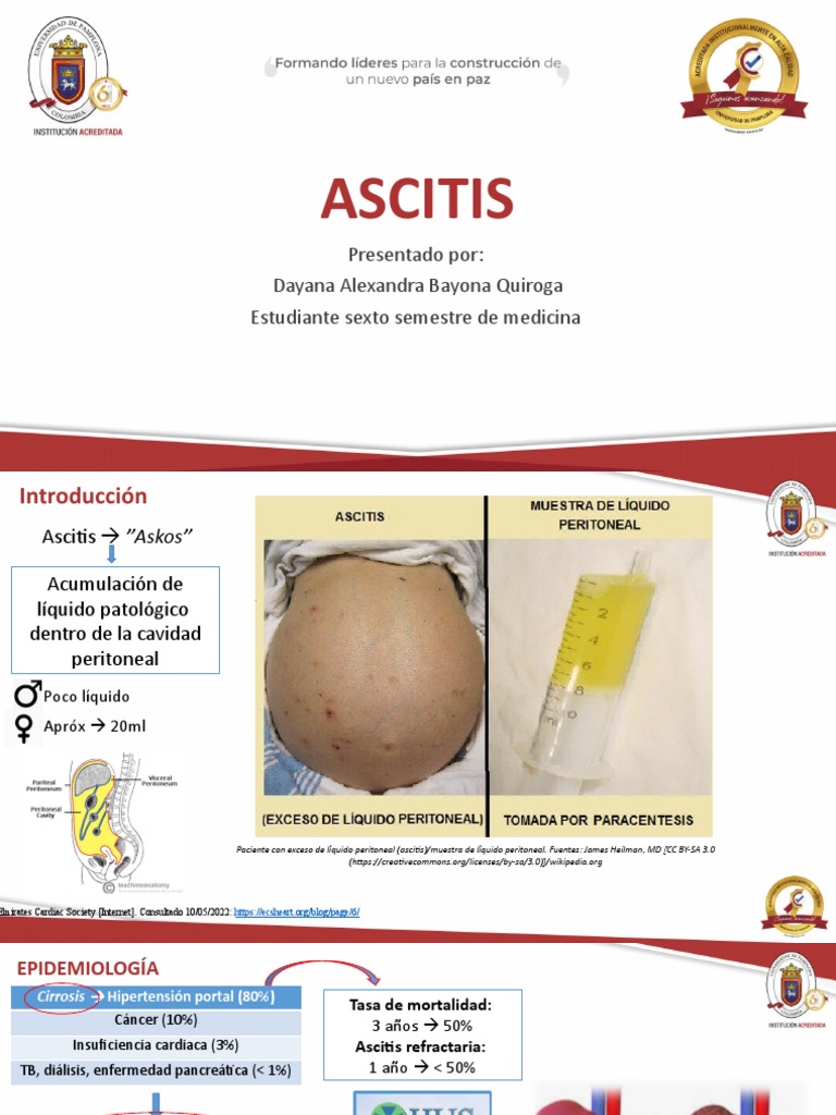 ASCITIS | PDF | Cirrosis | Especialidades Medicas