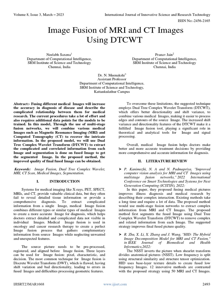 Image Fusion of MRI and CT Images Using DTCWT | PDF | Science & Mathematics | Computers
