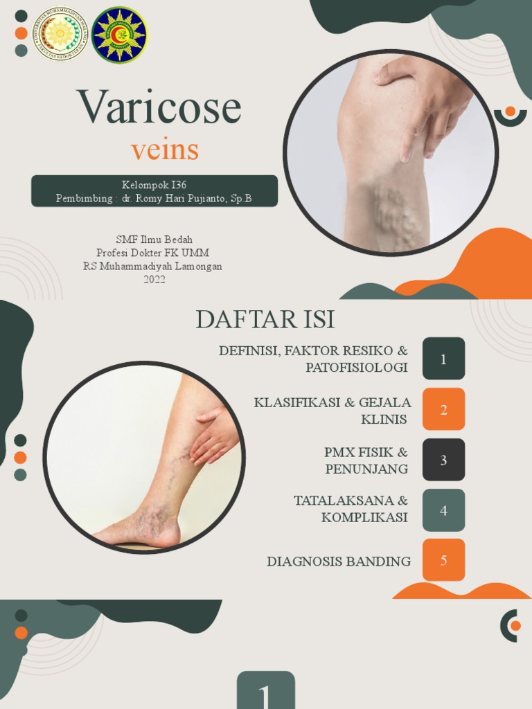 Varicose: Veins | PDF