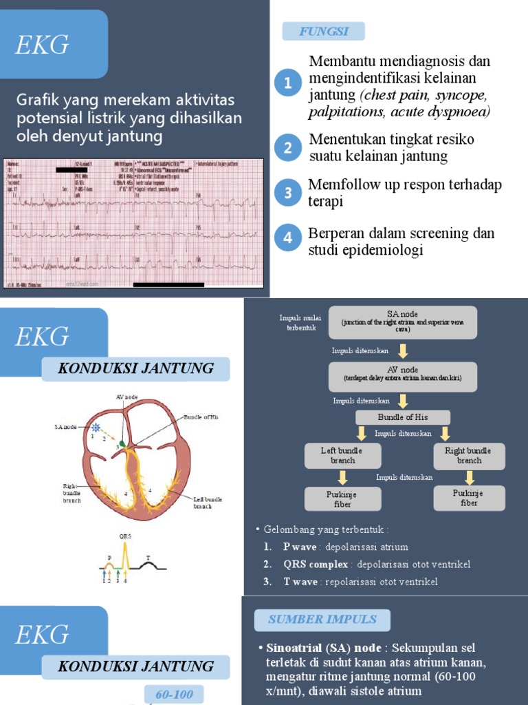 Panduan Lengkap Interpretasi EKG | PDF