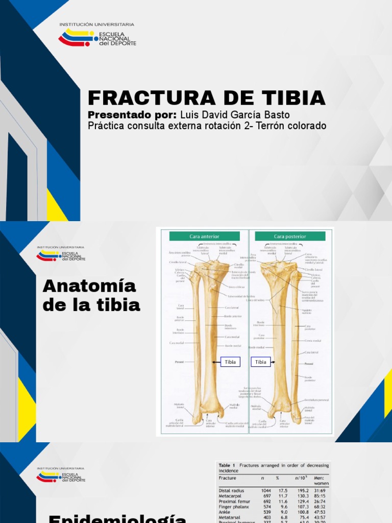 Clasificación y manejo de fracturas de tibia | PDF | Enfermedades y ...