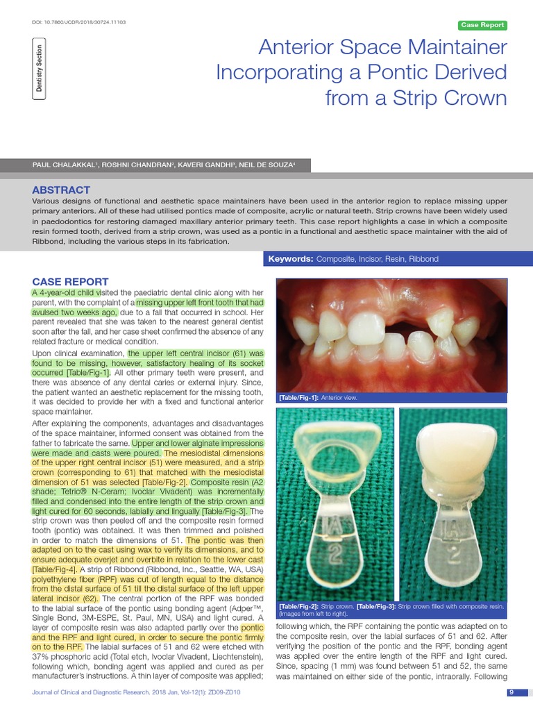Anterior Space Maintainer Incorporating A Pontic D | PDF | Dentistry | Dentistry Branches