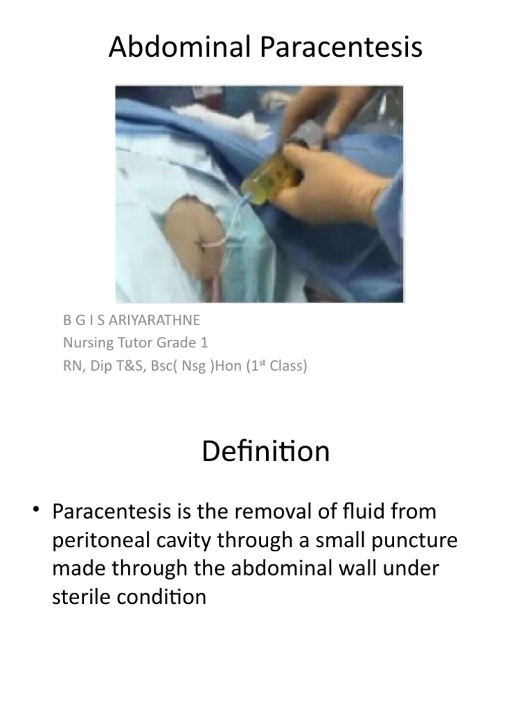 Abdominal Paracentesis Guide | PDF