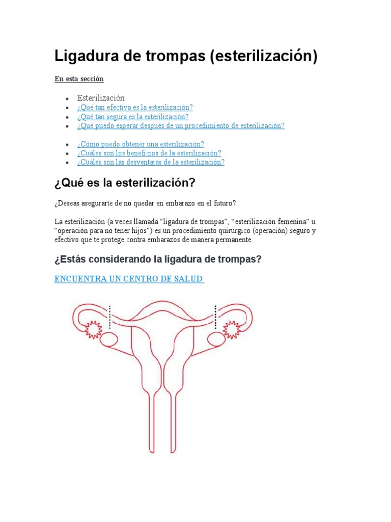 Ligadura de Trompas | PDF | Control de la natalidad | Condón