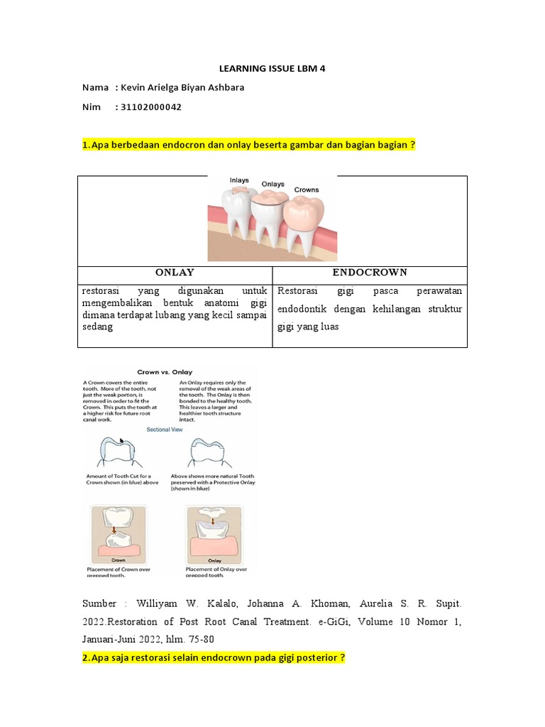KOMPREHENSIF RESTORASI GIGI POSTERIOR | PDF