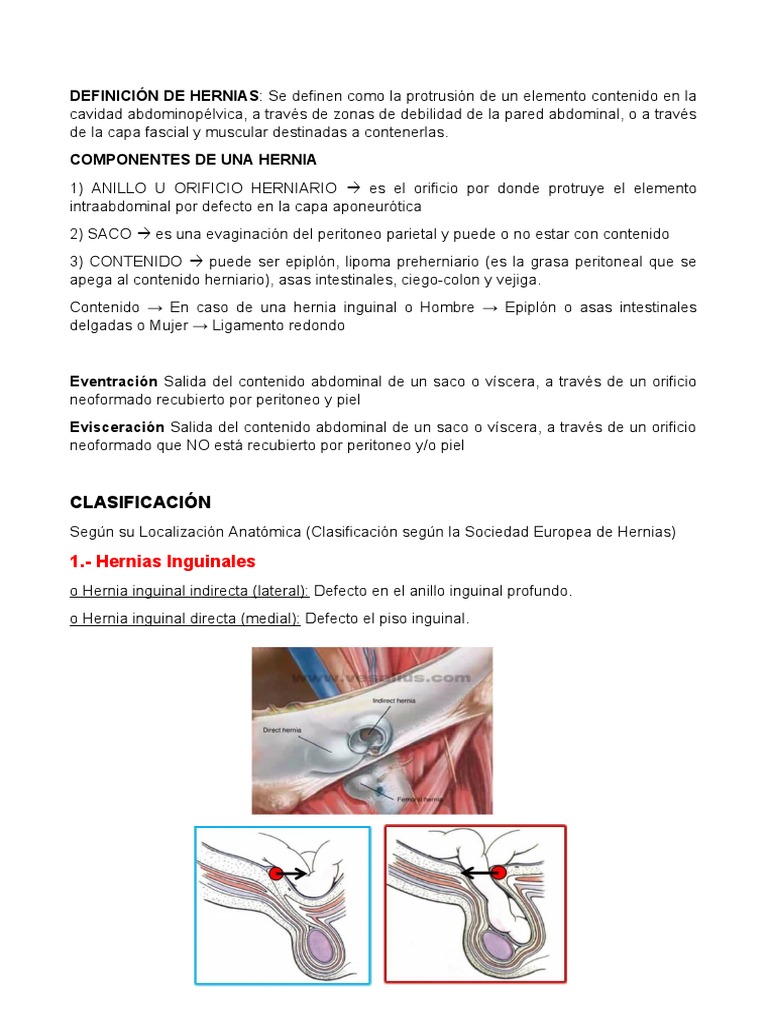Guía Completa sobre Hernias Abdominales | PDF | Abdomen | Peritoneo