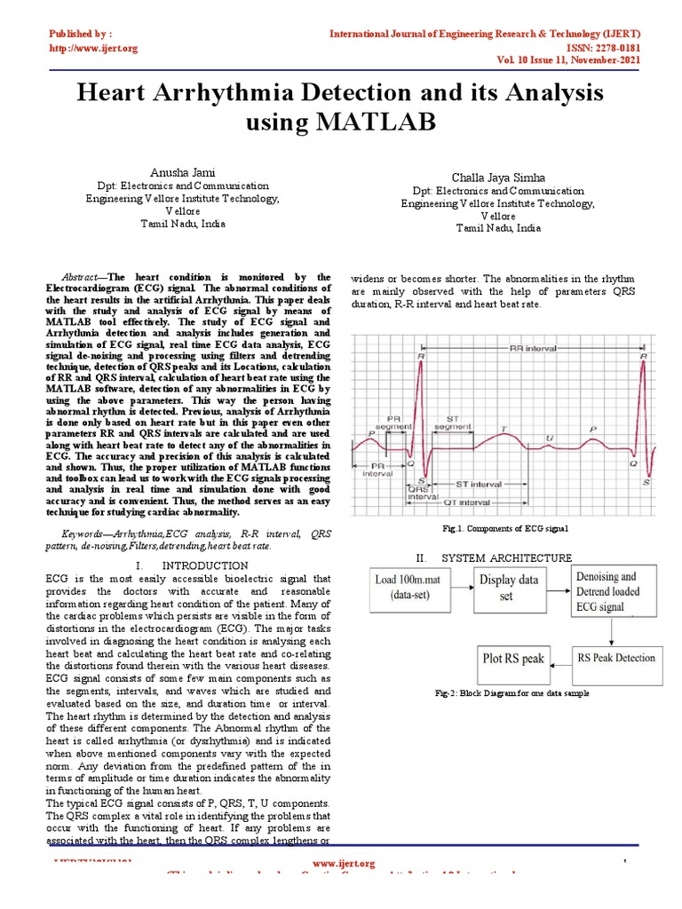 Heart Arrhythmia Detection And Its Analysis Using Matlab Ijertv10is110176 Pdf