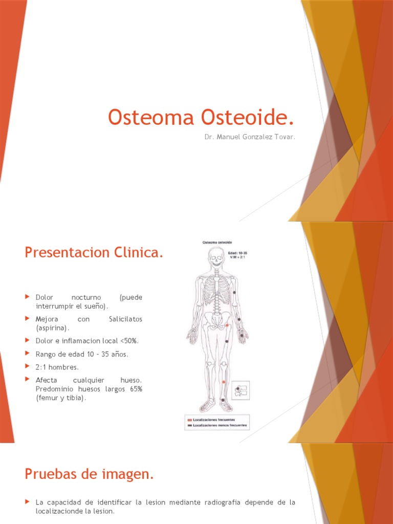 Osteoma Osteoide | PDF