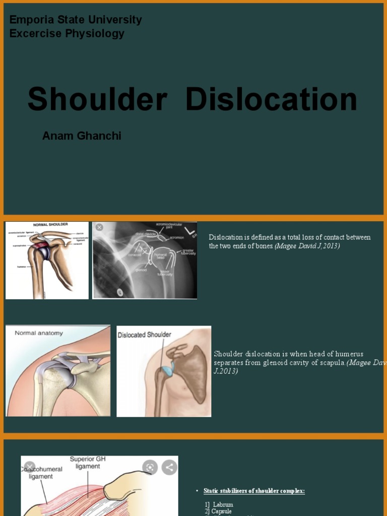 Rehabilitation OF Atheletes with shoulder DISLOCATION PPT | PDF ...