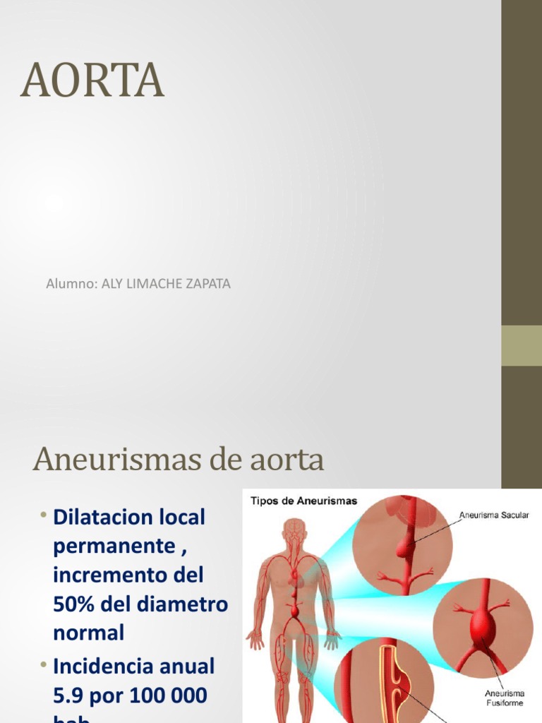 Aorta | PDF | Aorta | Enfermedades cardiovasculares