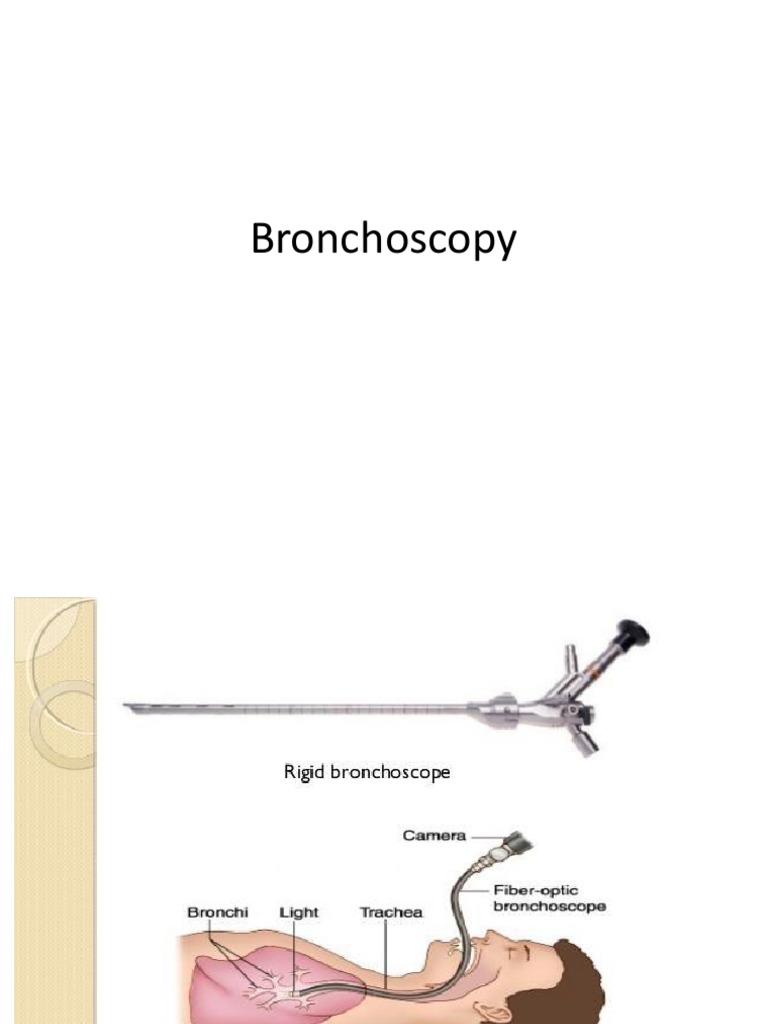 Bronchoscopy: A Guide to its Uses, Procedures, Findings, and ...