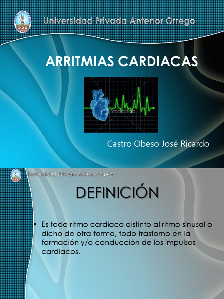 Arritmia Cardiaca | PDF