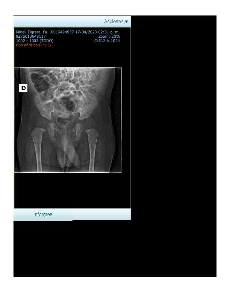 Vue Motion PDF | PDF