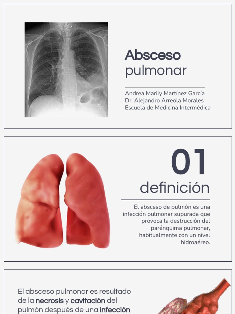 Absceso Pulmonar | PDF | Neumonía | Medicina CLINICA