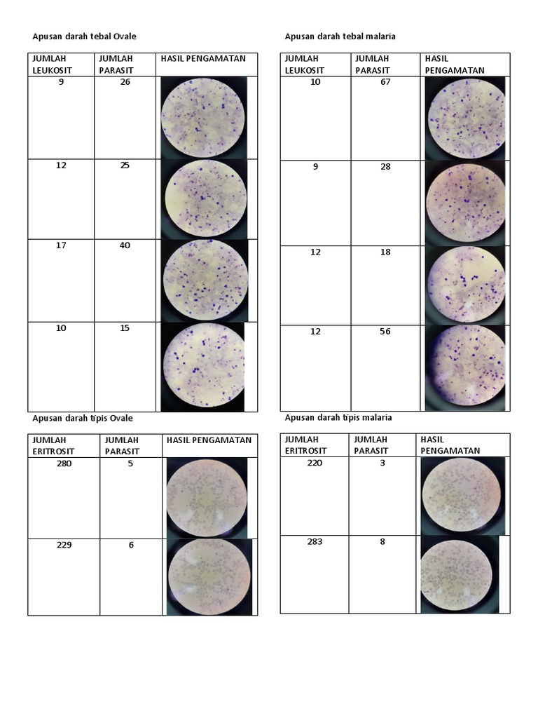 Apusan Darah Tebal Ovale | PDF