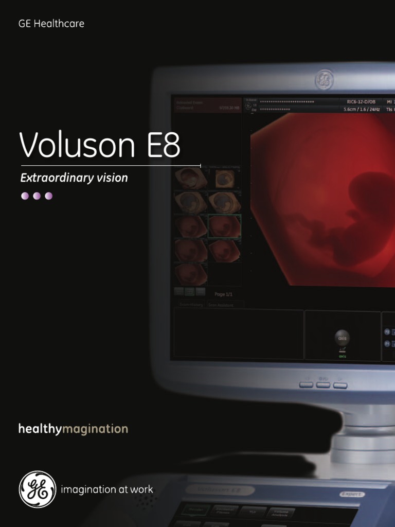 GE Voluson E8 Ultrahang - Brosura | PDF | Medical Ultrasound | Medical ...
